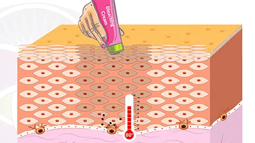 A Deep Dive into the Cause & Treatment of Melasma - AMA Regen Med ...