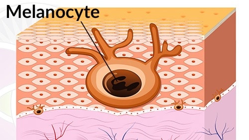 A Deep Dive into the Cause & Treatment of Melasma - AMA Regen Med ...