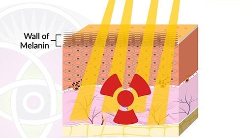 A Deep Dive into the Cause & Treatment of Melasma - AMA Regen Med ...